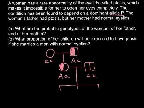 Ptosis - Dominant genetic disorder problem and solution