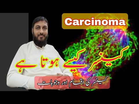 What is Cancer hindi urdu | CA | Carcinoma | Lymphoma | Sarcoma| benign | Malignancy