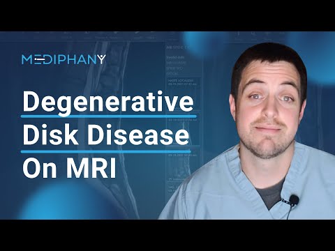 Degenerative Changes of the Lumbar Spine on MRI