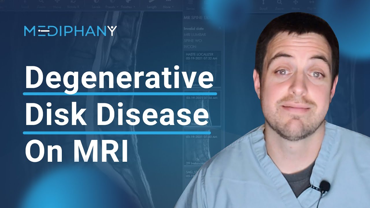 Degenerative Changes of the Lumbar Spine on MRI