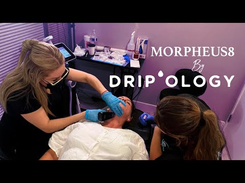 Morpheus8 by Dripology l Before and Afters