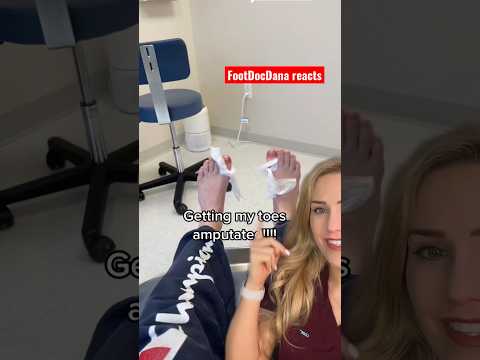 Doctor reacts: toe amputation