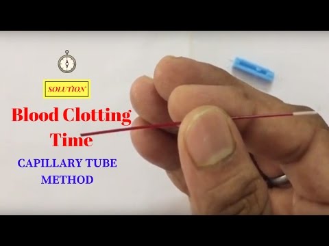 Capillary Tubes - Glass Capillary Latest Price, Manufacturers & Suppliers