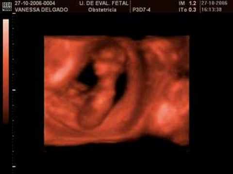 IMAGENES BEBE 12 SEMANAS - Imagui