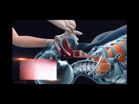 Video Stylet intubation training demo