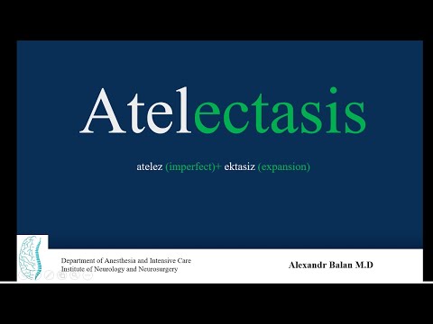 Atelectasis
