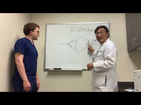 EyeWonder: Papilledema