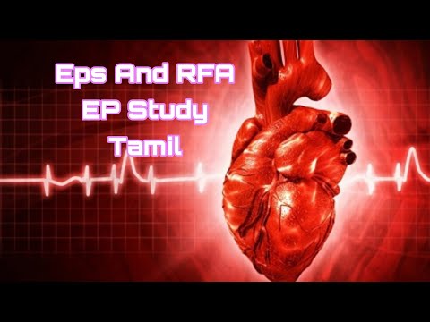 EPS and RFA Study in Tamil | EP Study | Medical | abnormal heart beat @VSDVIBE