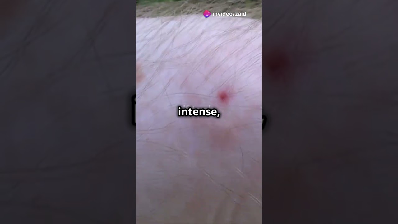 the most painnfull Insect bite ever!