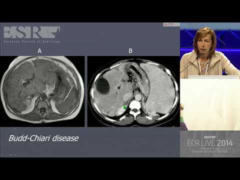 GI - Pitfalls in abdominal imaging 1