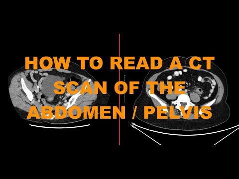 How to read a CT abdomen pelvis scan - introduction to abdominal imaging for junior doctors