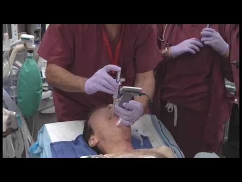 Awake intubation with King Vision Channeled blade - from AoD