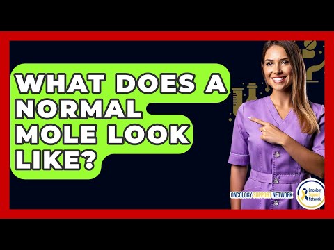 What Does A Normal Mole Look Like? - Oncology Support Network