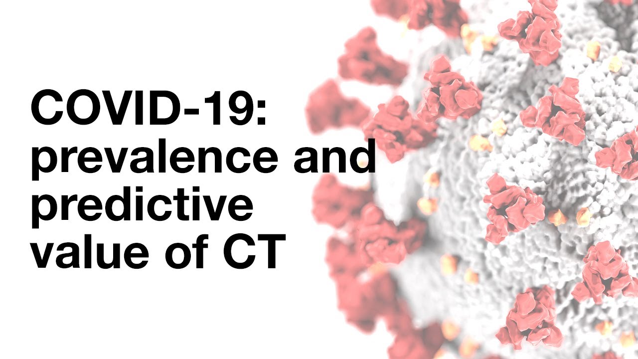 Covid-19 - Prevalence and Predictive Value.