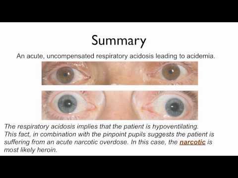 abg case studies #1