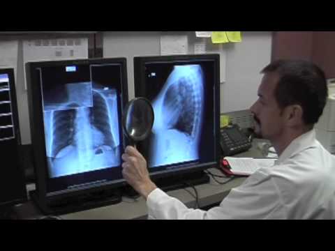 Day in the life of a PACS Administrator! | The Radiology Portal