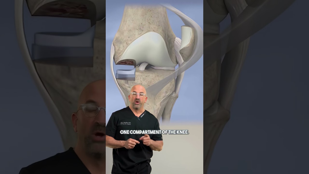 What’s the Difference? Total vs. Partial Knee Replacement #shorts