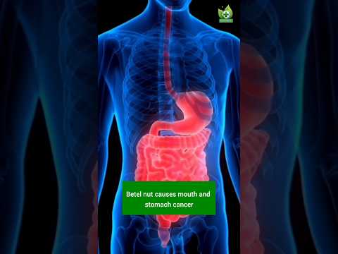 Results of eating betel nuts #health #healthtips #tips #betelnuts