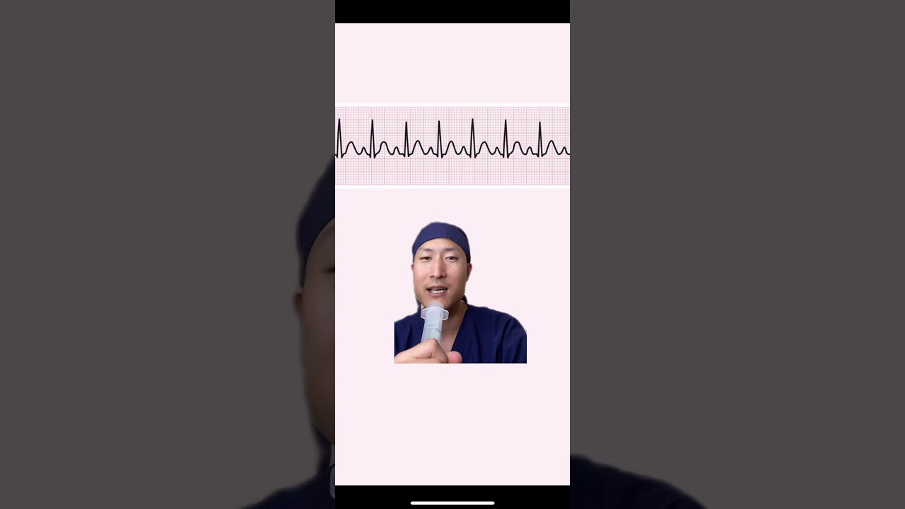 Reflex Tachycardia ❤️
