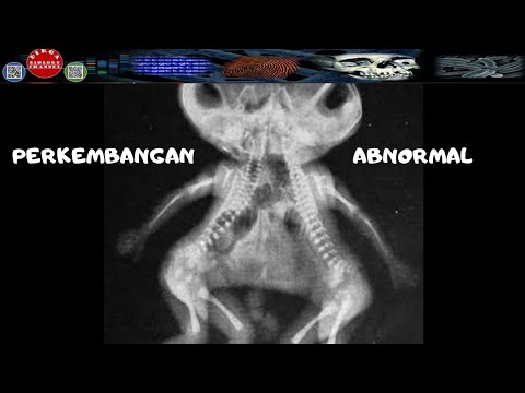 VIDEO ABNORMALITAS – DIRGA BIOLOGY CHANNEL
