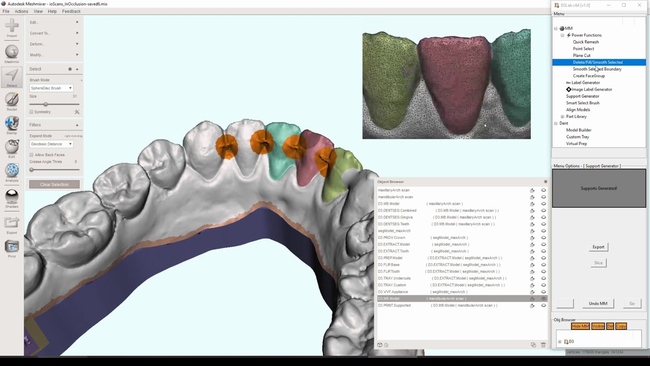 D3Lab x64  -  The Smart Select (Smart Segmentation) Brush, Power Functions and the Part Library