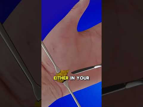 do you know your fingers feel numb #oneminutemed#medfacts #medical #medicaleducation #shorts