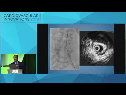 CVI2018 Session: 65 Year Old Female With Acute Limb Ischemia - Ahmad Younes, MD