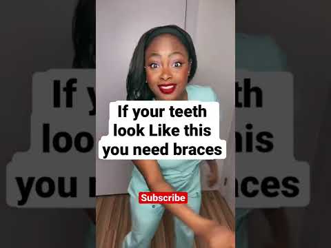 If your teeth looks like this you need braces #shorts #braces
