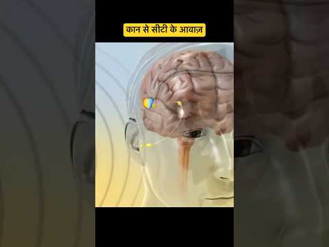 कान से सीटी की आवाज़ - ear ringing cause