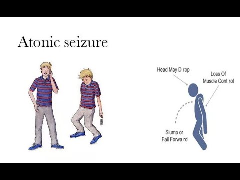 Tonic seizures And Atonic seizures ; Definition, Symptoms, Causes, Treatment, Differences