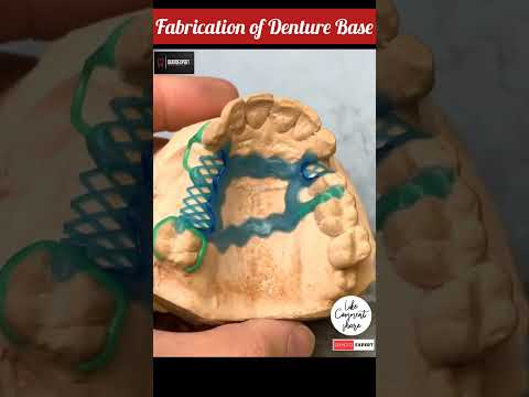 Cast Partial Denture Fabrication | Cast Partial Denture 💯 #shorts #dentist #viral 🔥