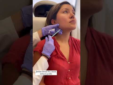 Botox to define the jawline #shorts
