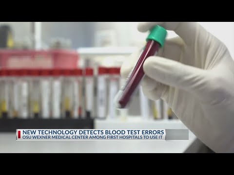 New Ohio State tech detects blood test errors