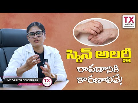 Skin Allergies: Causes, Precautions & Solutions with Dr. Aparna Krishnappa || TX Hospitals