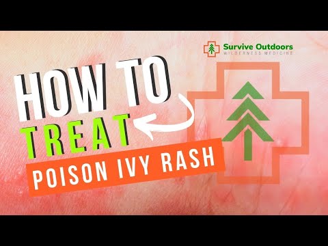 How to Treat Poison Ivy Rash