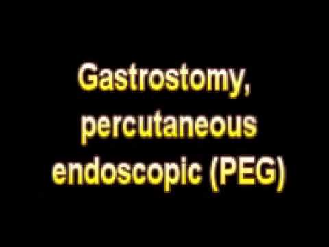What Is The Definition Of Gastrostomy, percutaneous endoscopic PEG