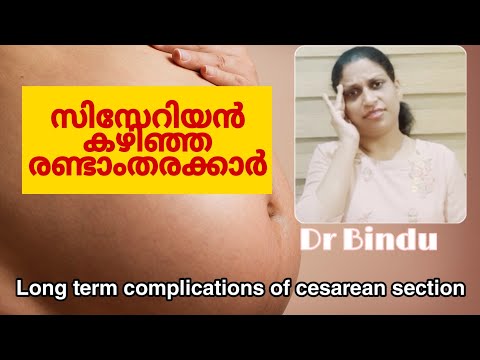 സിസേറിയനിലൂടെ പ്രസവിച്ചവർ അറിയാൻ/Are health problems more in Cesarean section?/Explained in detail