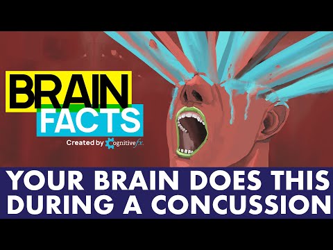 What happens to your brain during a concussion | Brain Facts #shorts