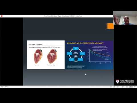MitraClip: Help for a Leaky Mitral Valve: Muhammad Raza, MD