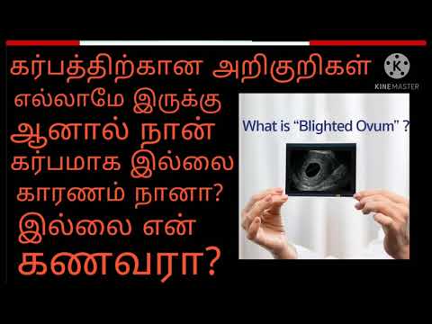 #empty gestational sac#blighted ovum/கர்பத்திற்கான அறிகுறிகள் இருந்தும் கர்பமாக இல்லை