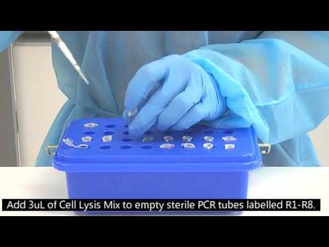 Cell Lysis