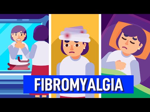 Fibromyalgia | A Whole Body Pain Experience and Fatigue