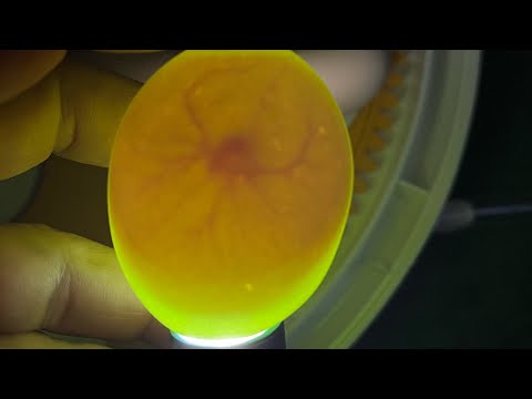 Candling eggs: Day 10 and what it should look like.
