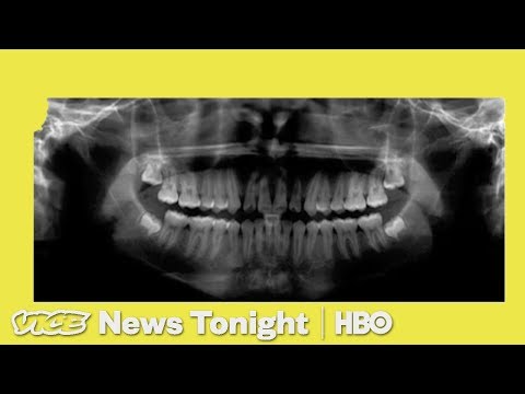 The U.S. Is Checking Immigrant Kids Teeth To See If They Belong In Adult Detention (HBO)
