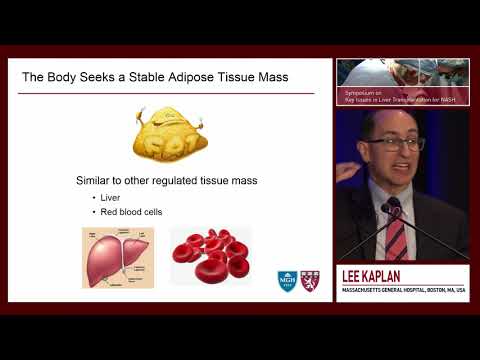 What is an acceptable BMI | Lee Kaplan, MD, PhD