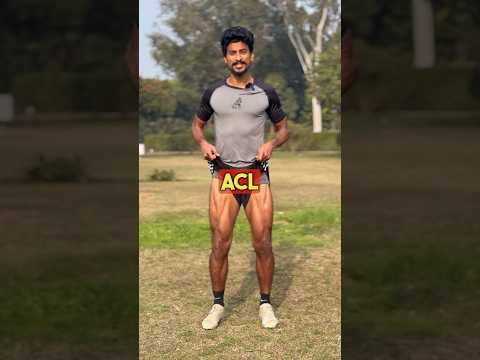 3 ACL tears 🦵#acl #acltear #aclsurgeryrecovery #kneeinjury