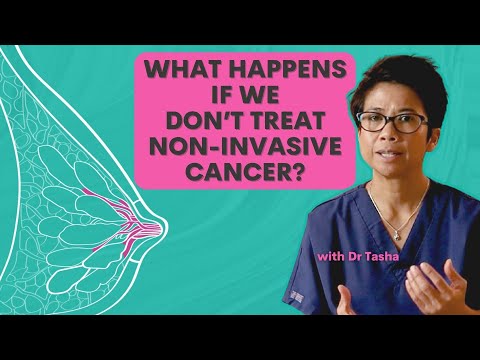 What is DCIS and What Happens if We Don't Treat It? - with Dr Tasha