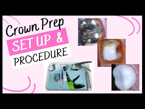 TRADITIONAL CROWN PREP SET UP & PROCEDURES // Tips For Dental Assistants