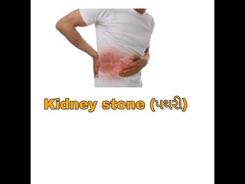 Kidney stone meaning in Gujarati