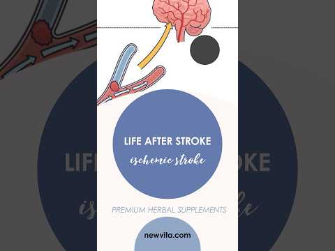 Life After Stroke: What is Ischemic stroke?